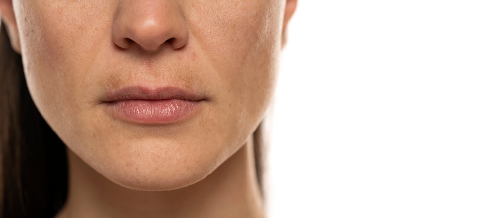 Why Do Lips Turn Black Without Smoking? | Causes & Natural Solutions ...